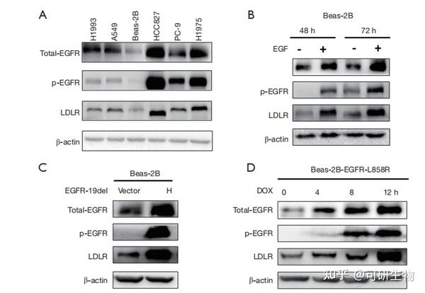 EGFR突变非小细胞肺癌的一种有前途的代谢疗法 - 知乎