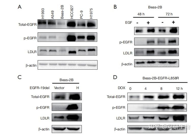 EGFR突变非小细胞肺癌的一种有前途的代谢疗法 - 知乎