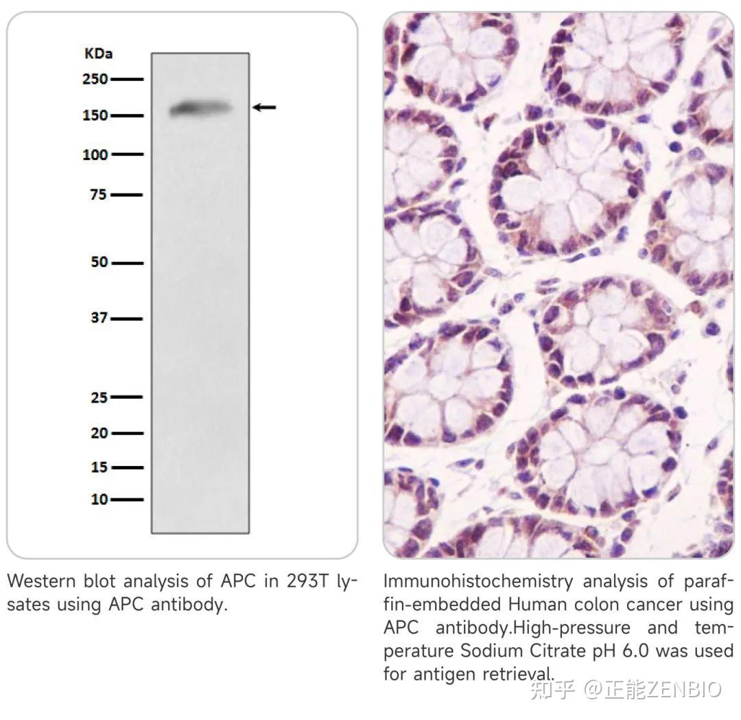 【研究专题】细胞信号传导的关键角色—Wnt通路 - 知乎
