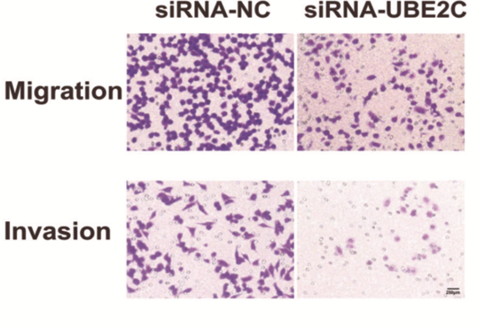 Destiny｜功能验证之Transwell实验 - 知乎