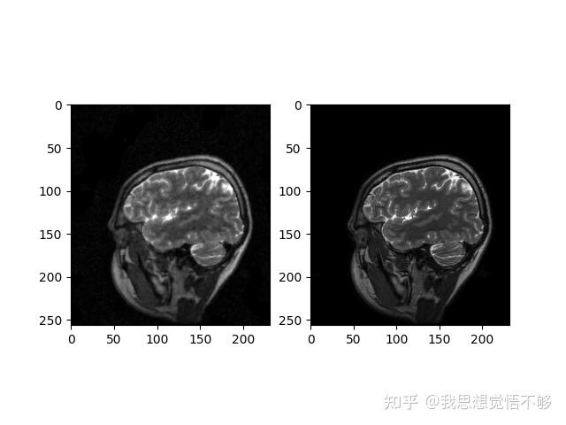MRI重建中的小实验（python） - 知乎