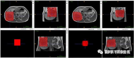 LLD-MMRI2023——多模态MRI 的肝脏病变诊断挑战 - 知乎