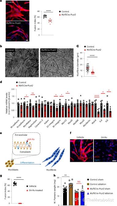 代谢学人——Nature Metabolism：PCYT2调控的脂质合成对与肌肉健康和衰老至关重要 - 知乎