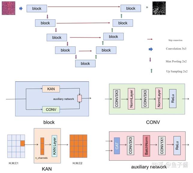 不得不服，这种KAN+UNet思路也太绝了！审稿人都得为你让条路！ - 知乎