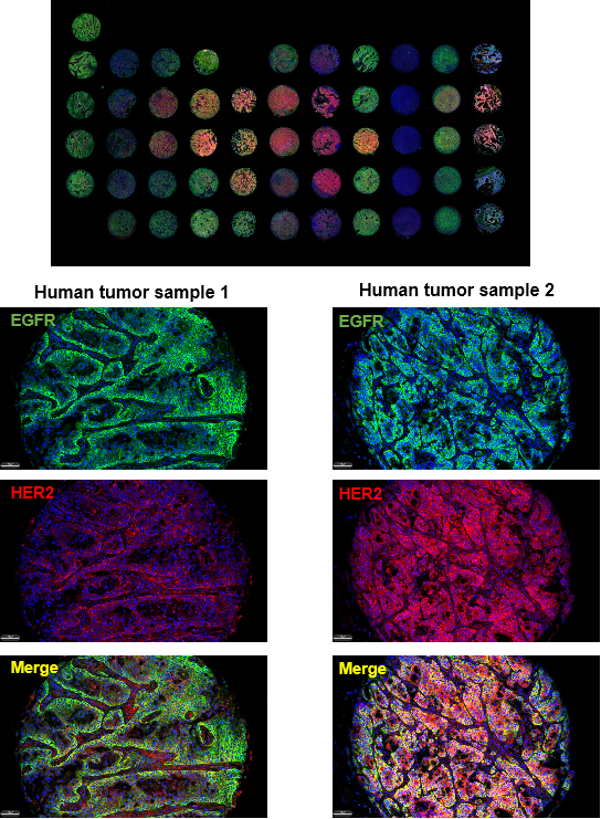 PDX模型，模拟真实肿瘤生长 - 知乎