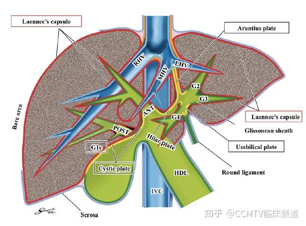 4 个问题掌握 解剖性与非解剖性肝切除术 - 知乎