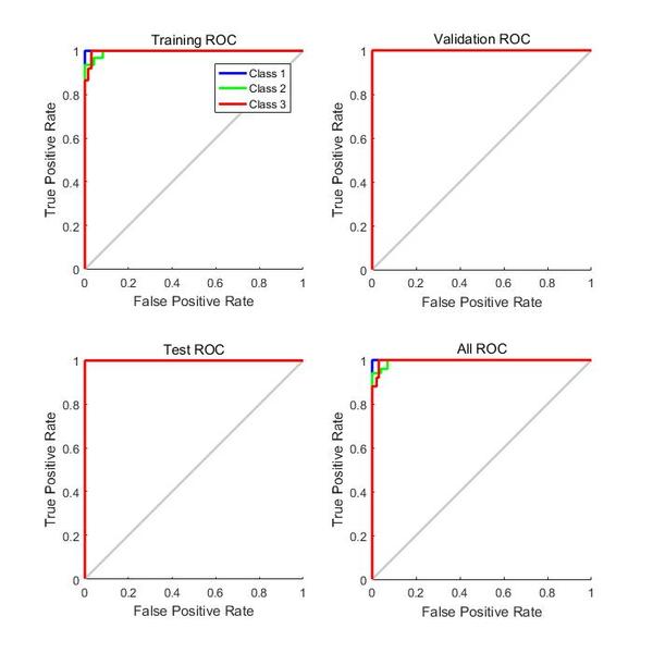 ROC曲线简介 - 知乎