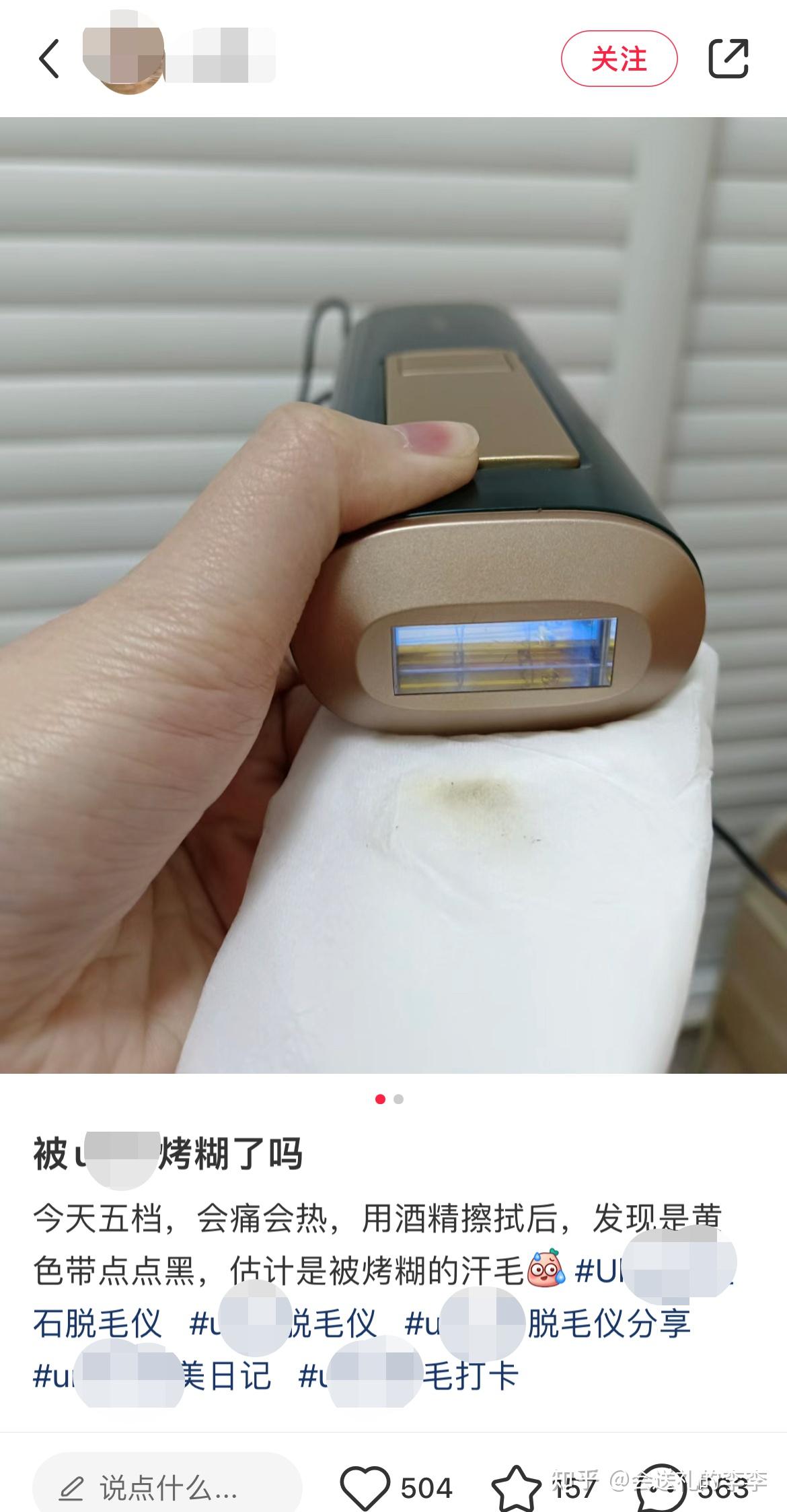 技术不输ulike，全网在夸的beautigo脱毛仪真实测评，据说还是性价比天花板！ - 知乎