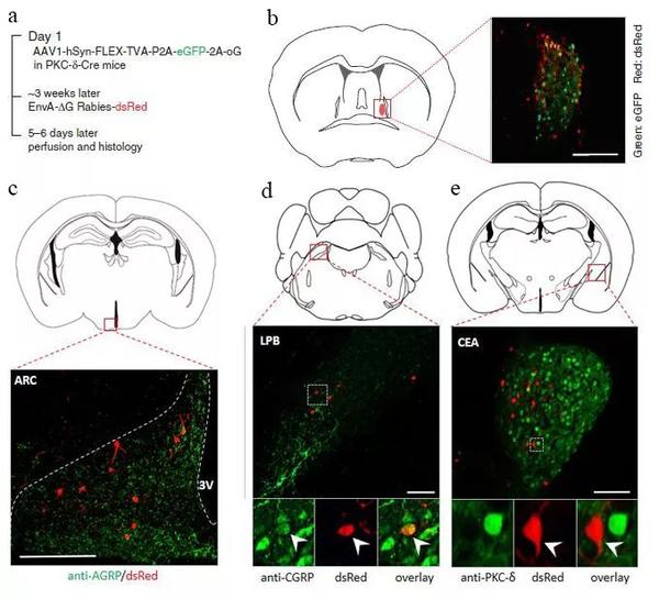 【文献解读】Nature Communications丨BNST相关微通路参与炎症介导的摄食调控 - 知乎