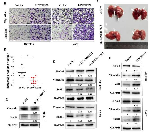 Mol. Cancer|徐医大揭示H3K27巴豆酰化促进结直肠癌转移的机制 - 知乎