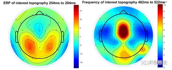 EPOS：EEG处理开源脚本 - 知乎