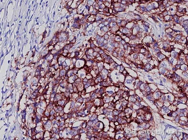小优进修班∣Naveni® PLA技术产品应用现状1 - 知乎