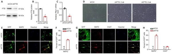 小布解读 | 有效治疗脊髓损伤的新策略——敲低多嘧啶束结合蛋白（PTB） - 知乎