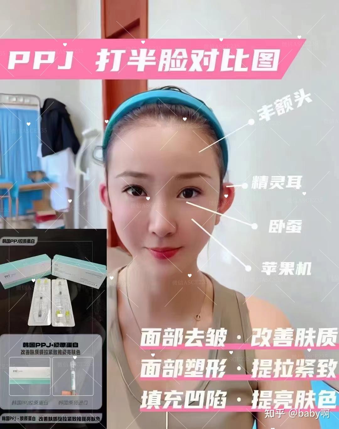 关于韩国ppj胶原全方面科普操作步骤注意事项！！ - 知乎