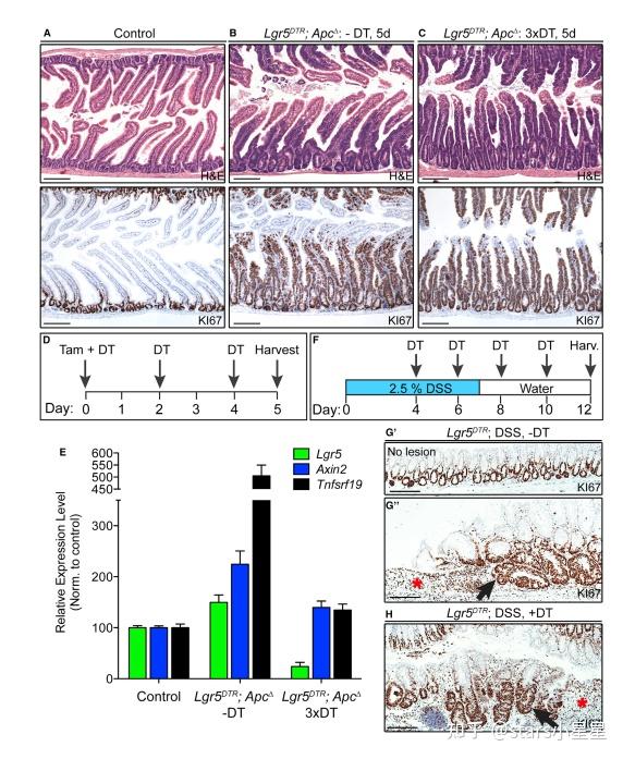 肠道再生2013Cell Stem Cell：Lgr5+干细胞在辐射诱导的肠道再生中是不可或缺的 - 知乎