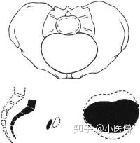 异常分娩产道异常 - 知乎