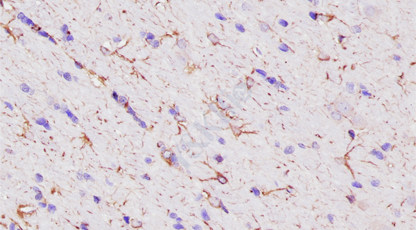 脑组织实验前处理方法及常做的染色 - 知乎