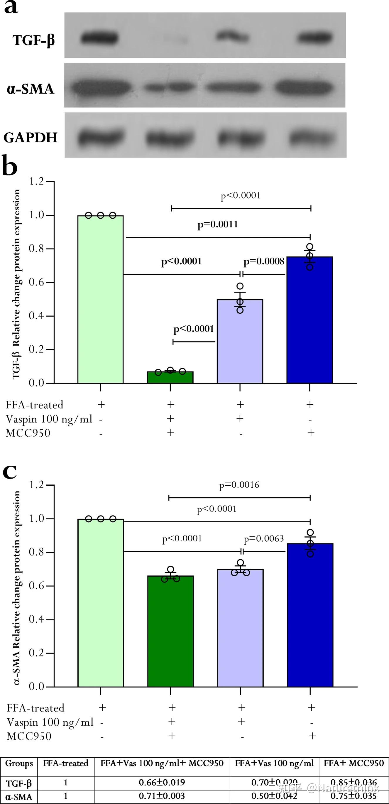 Vaspin靶向AMPK信号通路通过GRP78受体减轻脂肪变性诱导的纤维化 - 知乎