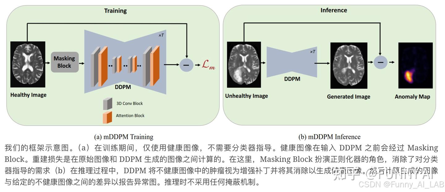 Diffusion异常检测相关论文及代码整理 - 知乎