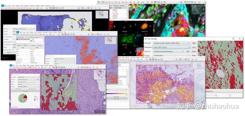 【笔记】QuPath用于免疫组化定量评估 - 知乎