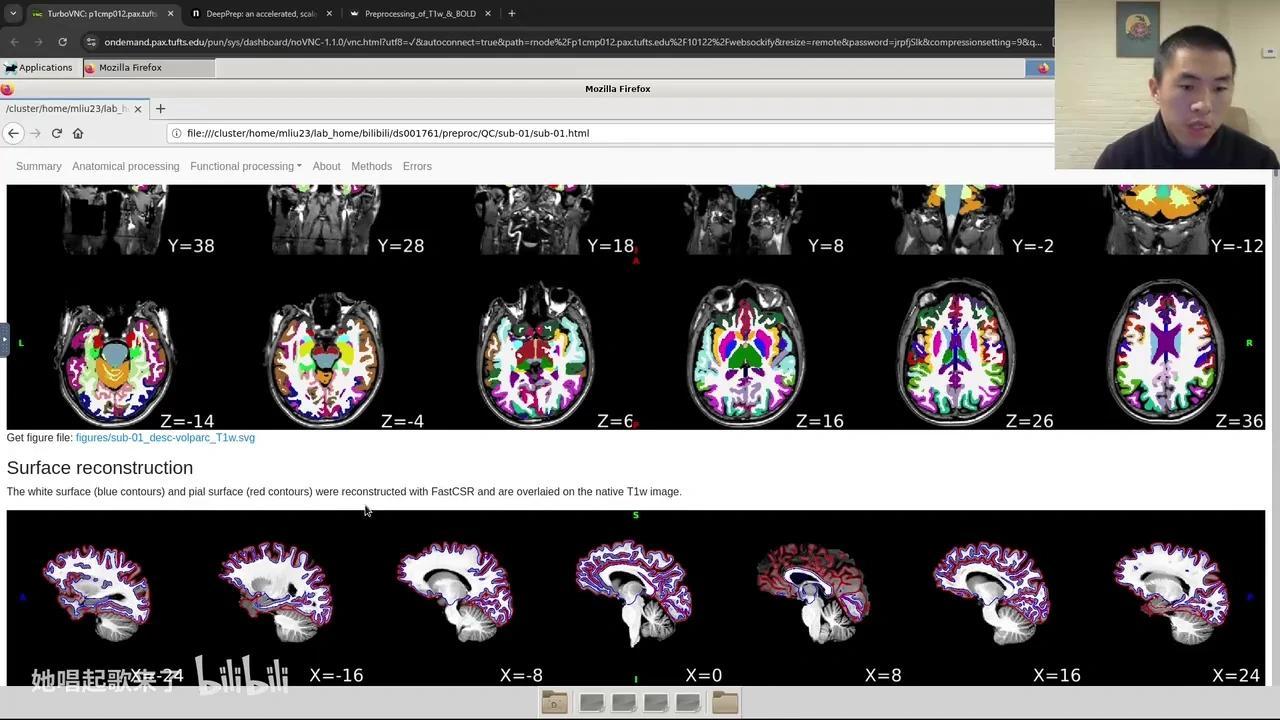 DeepPrep-基于深度学习的fMRI预处理工具 - 知乎