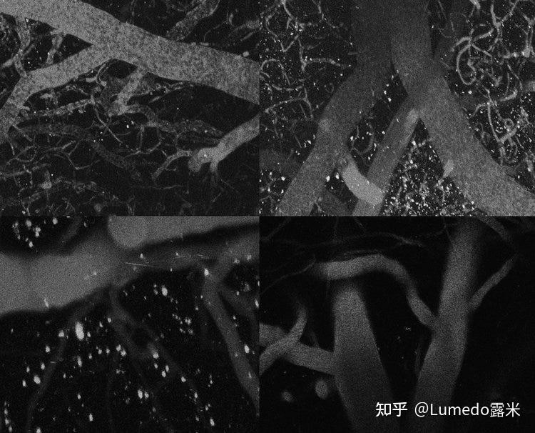 Danny roddy：亚里士多德的散热器，或：背景下的头发生长（二氧化碳、血清素和老龄化的全球降温) - 知乎