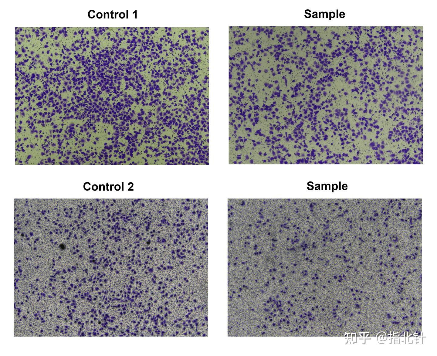 Transwell实验——原理、步骤、注意事项、示例图 - 知乎