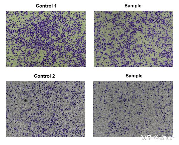Transwell实验——原理、步骤、注意事项、示例图 - 知乎