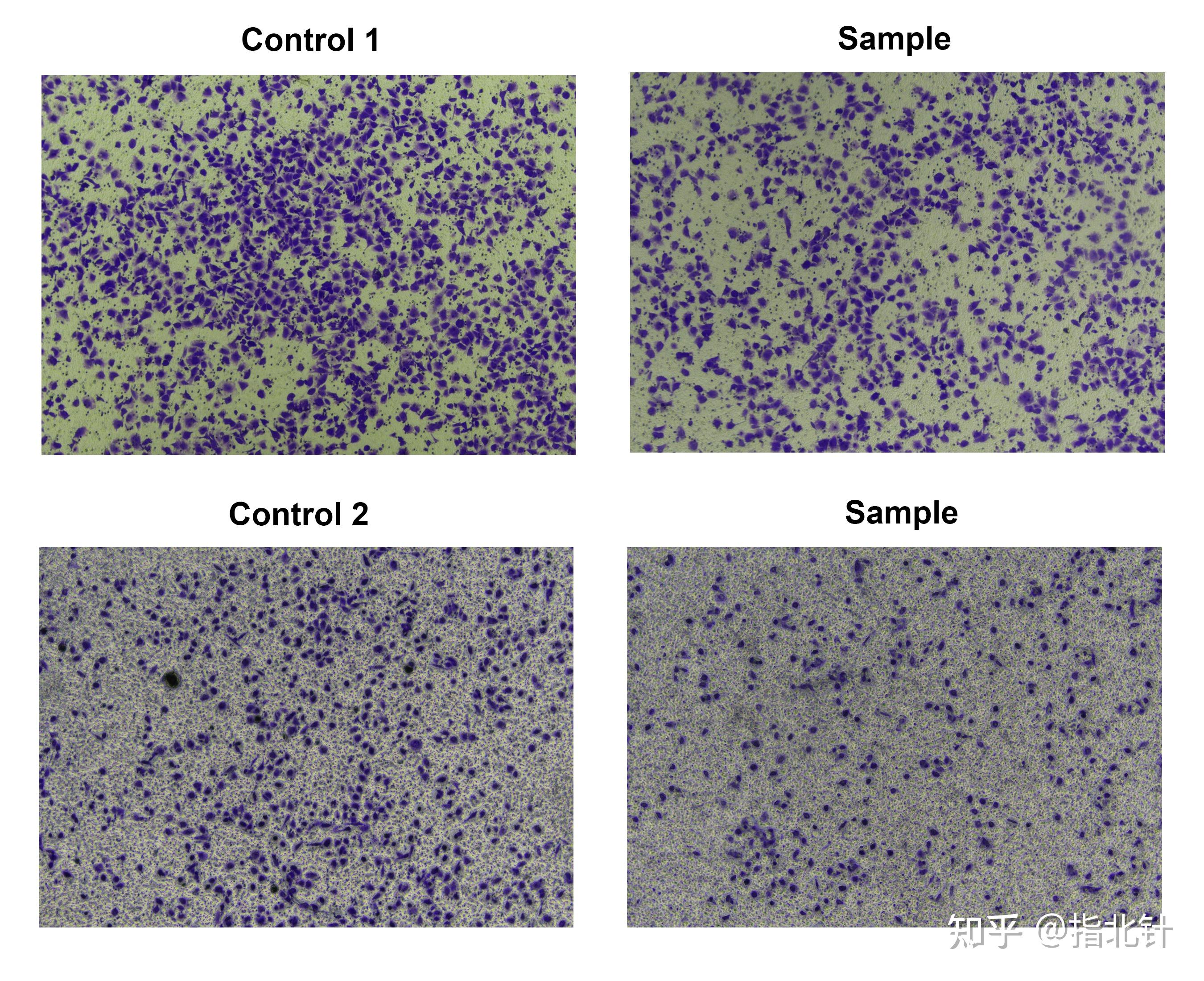 Transwell实验——原理、步骤、注意事项、示例图 - 知乎