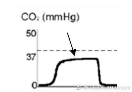 【宠物诊疗】麻醉中，为什么不可忽略ETCO2的监测？ - 知乎