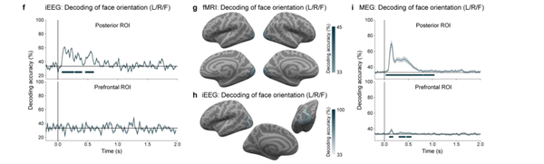 IIT vs GNWT：意识理论对比检验 - 知乎