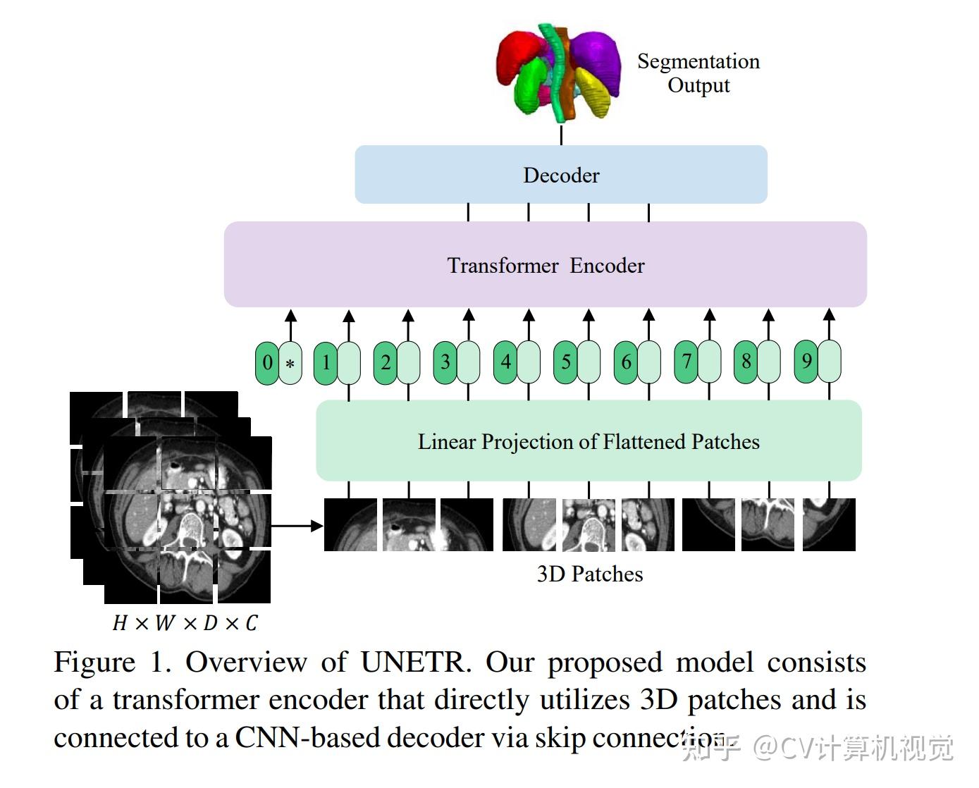 基于Transformer的医学图像分割15篇论文及开源代码 - 知乎