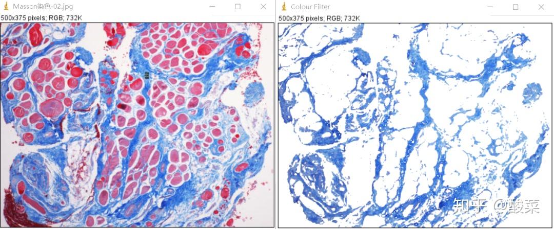 ImageJ高效图片分析技巧 - 知乎