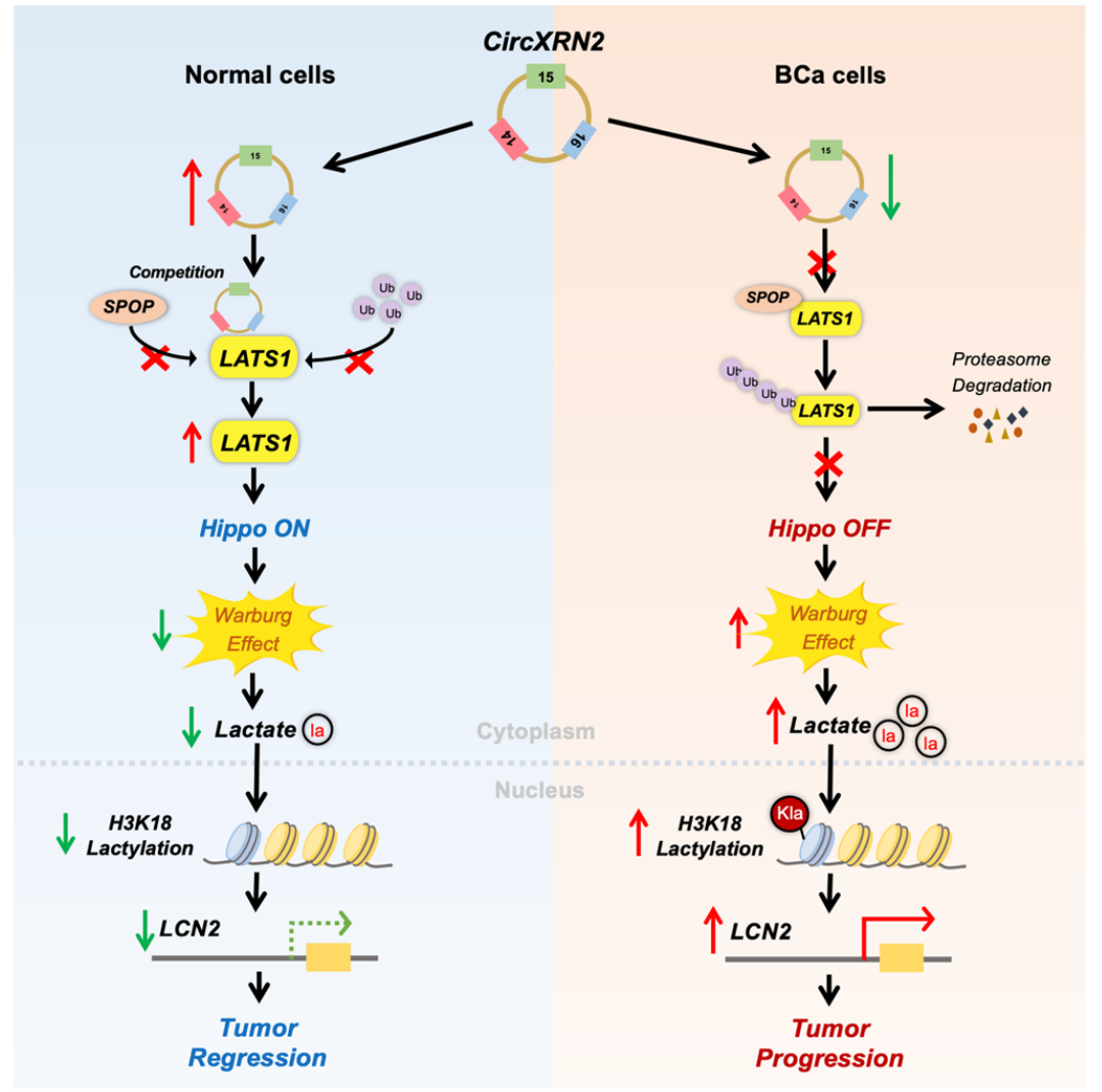 Mol. Cancer|浙大一院揭示H3K18乳酸化介导的膀胱癌进展调控机制 - 知乎