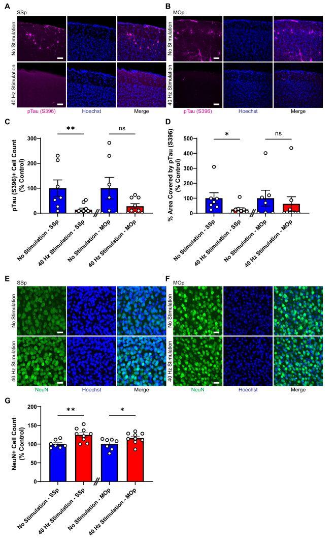 MIT蔡立慧团队最新报道40Hz震动刺激改善AD病理和运动表现 - 知乎