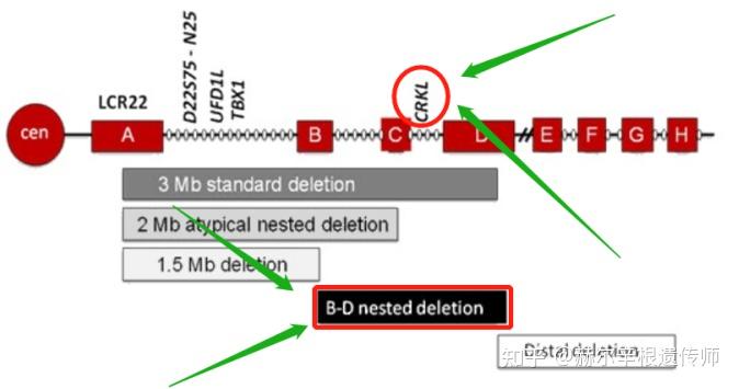 22q11.2区域缺失/重复综合征疾病介绍及应对策略 - 知乎