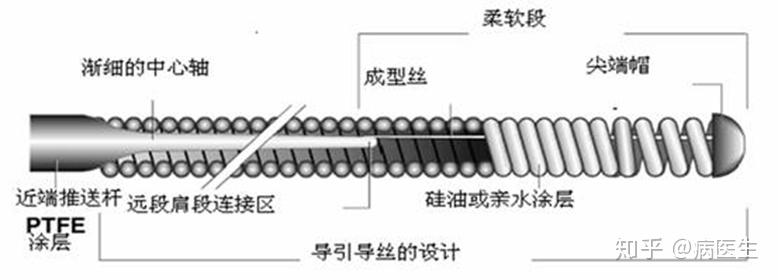 吻合口附近PTA的导丝尖端位置（一） - 知乎