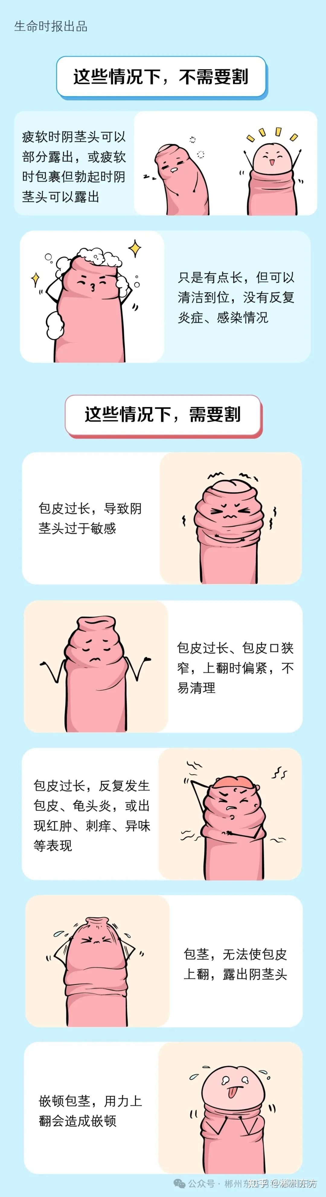 包皮手术是什么啊?包皮过长不割有影响吗? 知乎