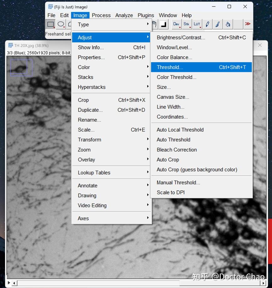 组化片子如何利用Image J 进行阳性信号面积占比统计分析 - 知乎