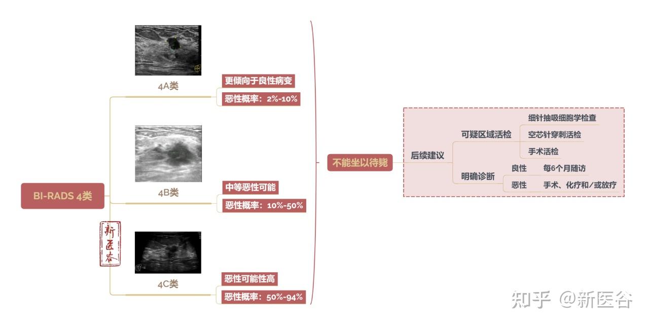 有了乳腺结节别着急，先正确认识BI-RADS分级！ - 知乎