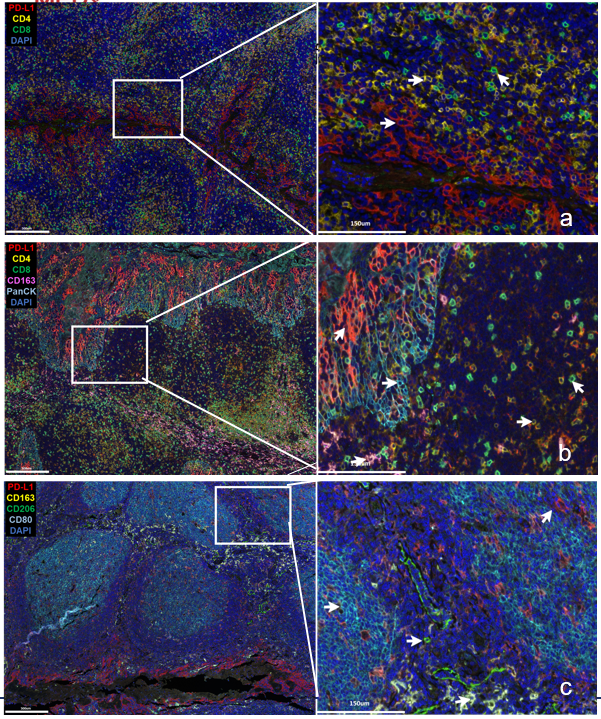 多重免疫荧光技术助力临床转化医学 - 知乎