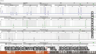 BxPC-3细胞培养，人原位胰腺腺癌细胞培养攻略 - 知乎