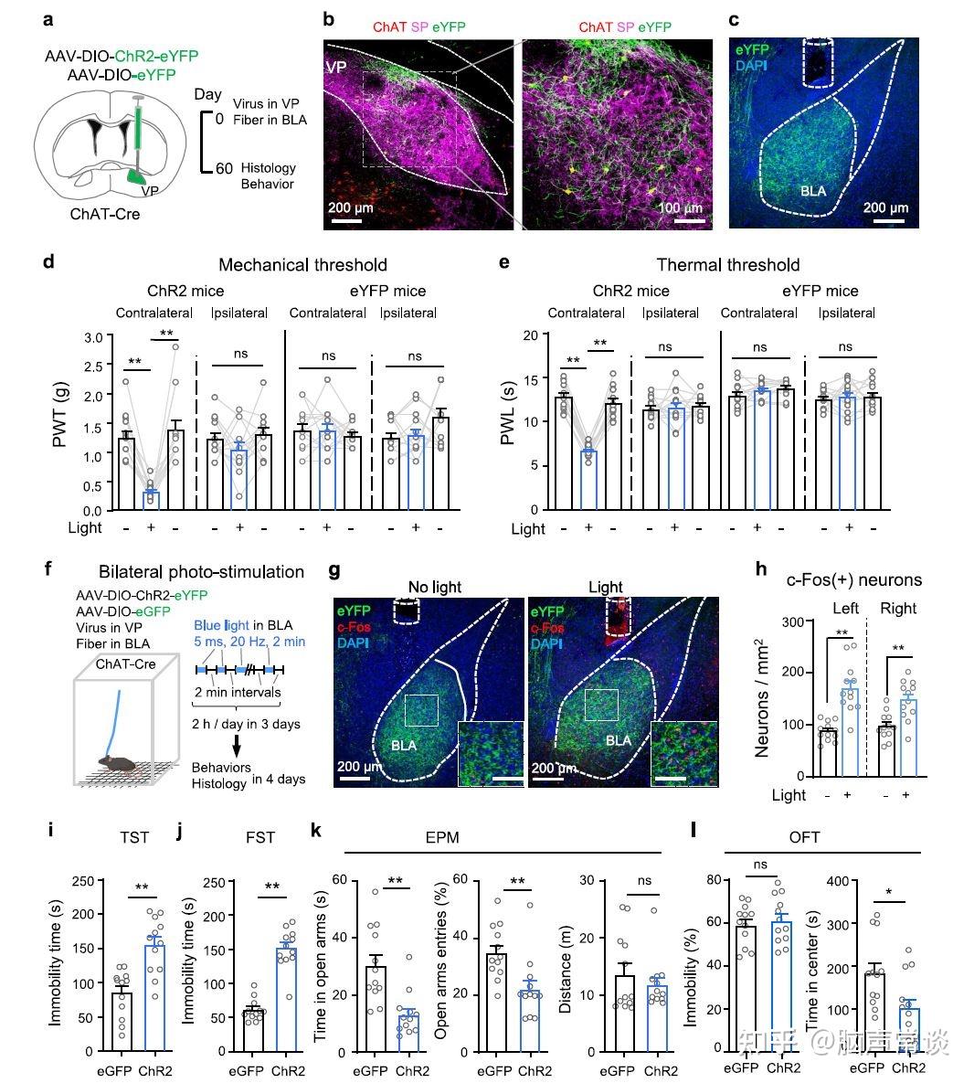 腹侧苍白球胆碱能环路调控慢性疼痛相关焦虑和抑郁情绪的神经环路机制 - 知乎