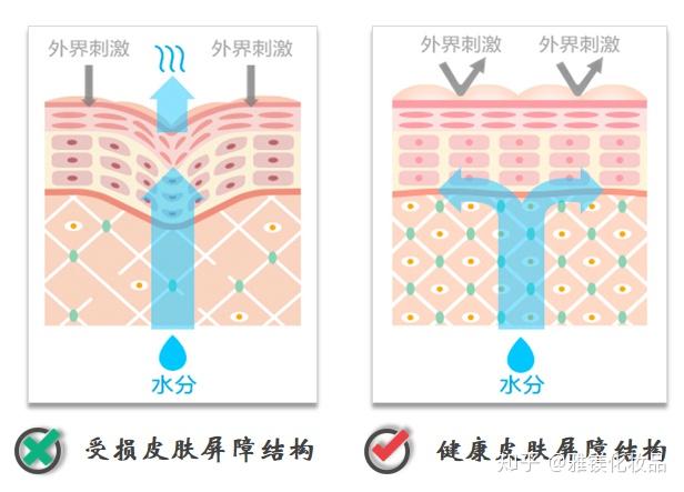 神经酰胺精华丨修复皮肤屏障，改善肌肤敏感 知乎