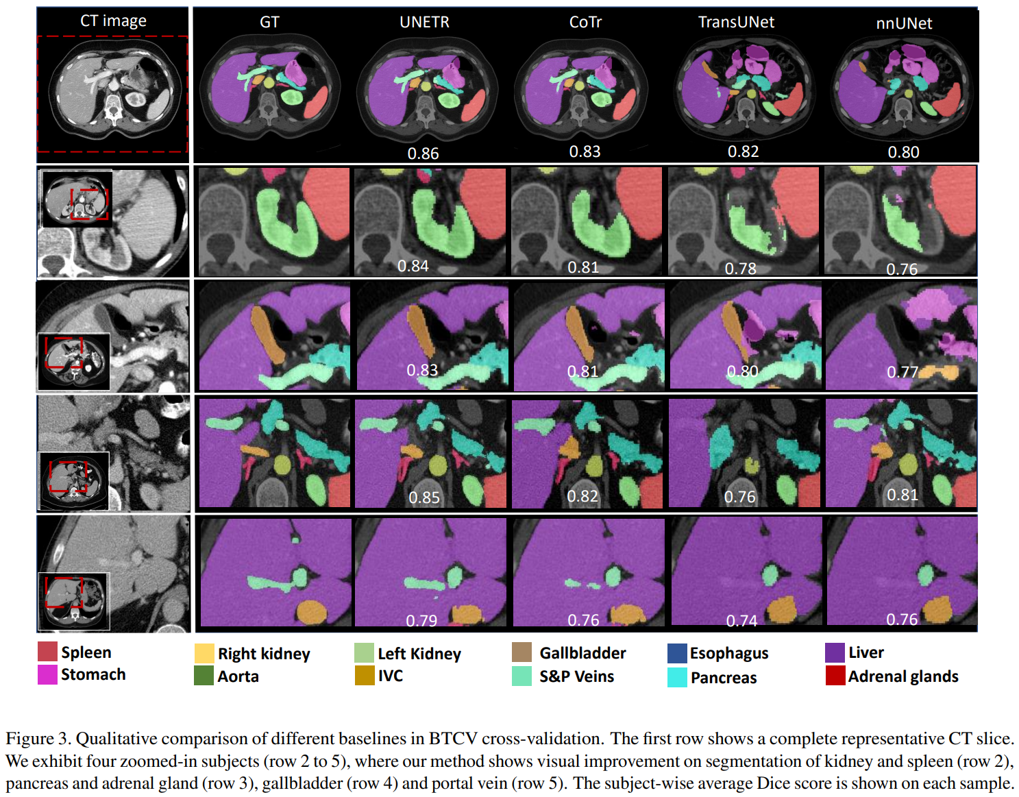 【WACV 2022】UNETR：用于 3D 医学图像分割的Transformer（research-contributions） - 知乎