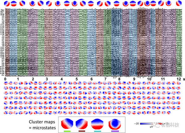 高分辨率EEG的空间分析 - 知乎