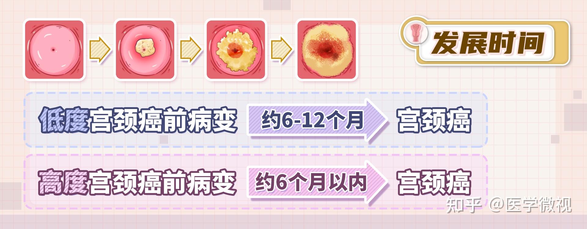 一篇文章，教你看懂宫颈TCT检查结果！ - 知乎