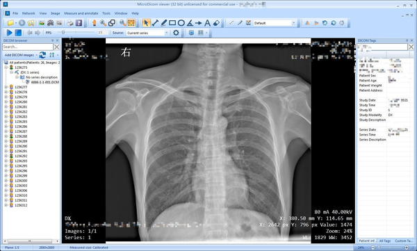 DICOM 图像浏览器和影像科研平台推荐（附 Radiant Viewer、3D Slicer 安装包） - 知乎