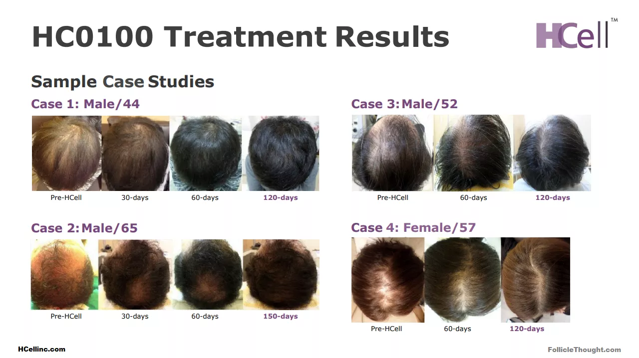 聊聊资生堂的RCH-01和HCell公司 - 知乎
