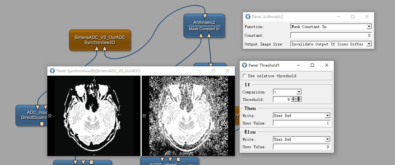 用MeVisLab来计算ADC值，并做对比（下） - 知乎
